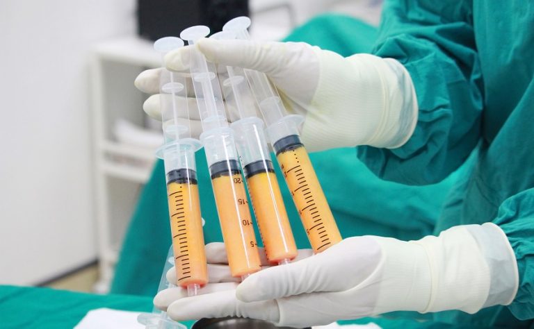 Fat Transfer Breast Augmentation: Everything You Need to Know